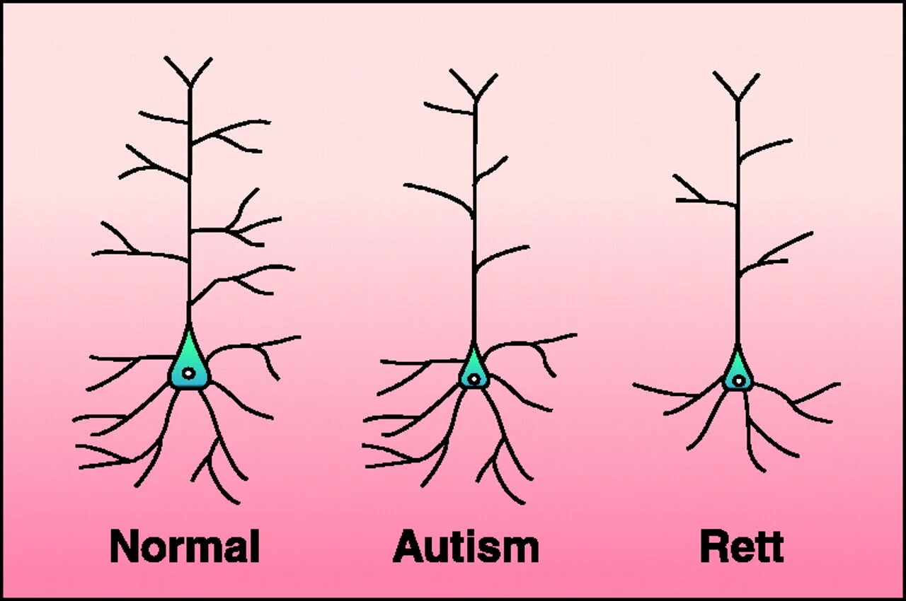 A Primer on the Abnormal Neurobiology of Autism — NCSA