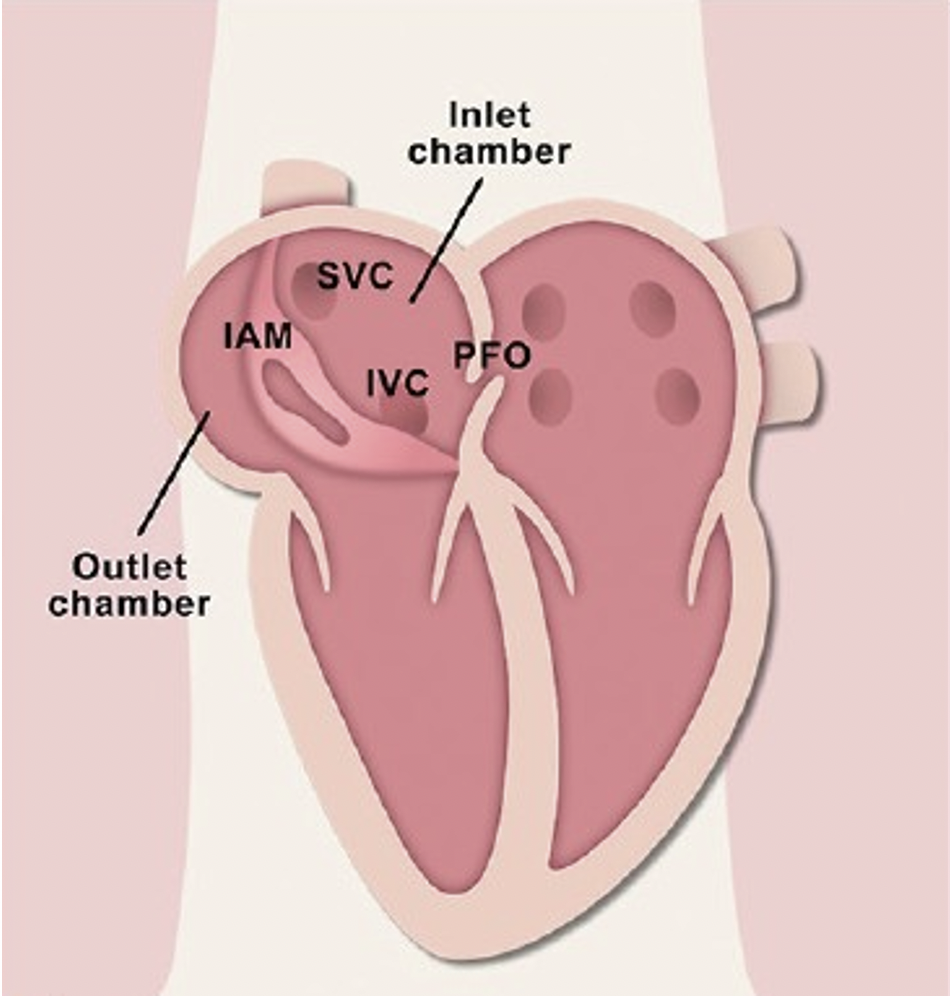 January's Case of the Month — MivuDC