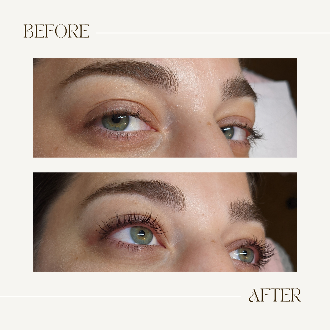 Eyelash Perm And Tint Before And After