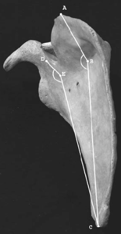 Snapping Scapula Syndrome — Dynamic Physio Therapy | Naples, FL ...