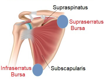 Snapping Scapula Syndrome — Dynamic Physio Therapy | Naples, FL ...