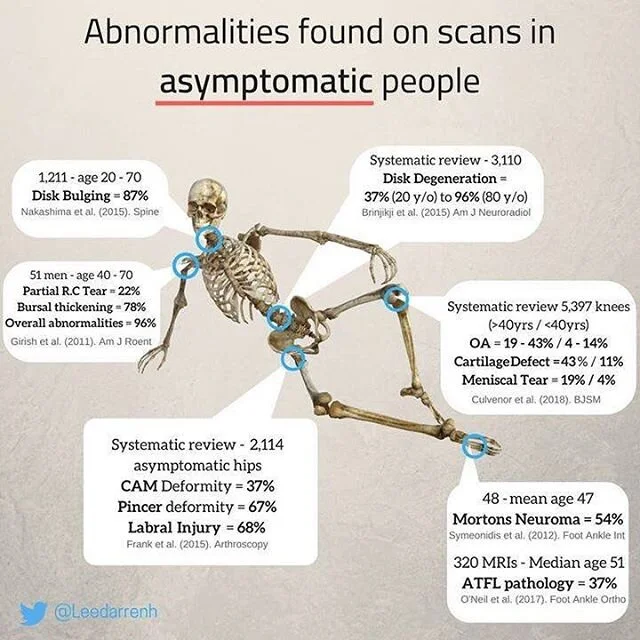 You Are Not Your MRI; Myths About Low Back Pain — Dynamic Physio ...