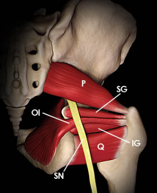 Quadratus Femoris and Hip Impingement (FAI) — Dynamic Physio Therapy ...