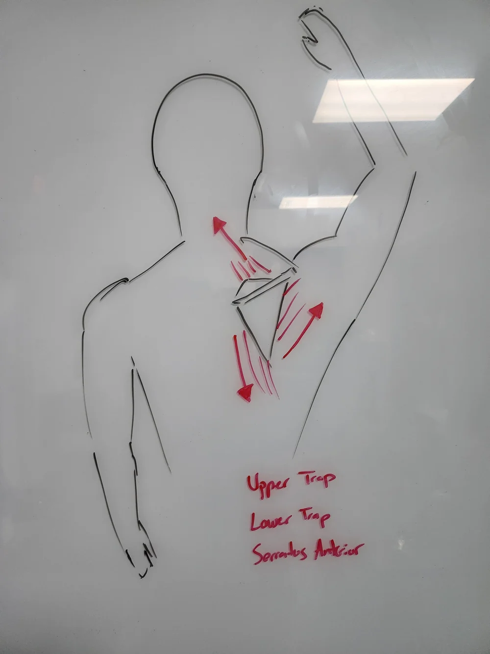 Pain in the Neck - The Upper Trap — Dynamic Physio Therapy | Naples, FL ...