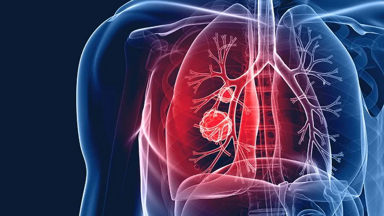 Oncology MAPS: One of a Kind Cancer Diagnostic System — Protean BioDx