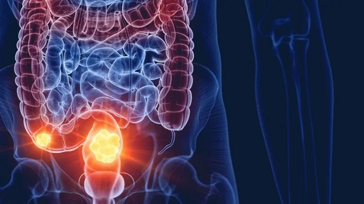 Oncology MAPS: One of a Kind Cancer Diagnostic System — Protean BioDx