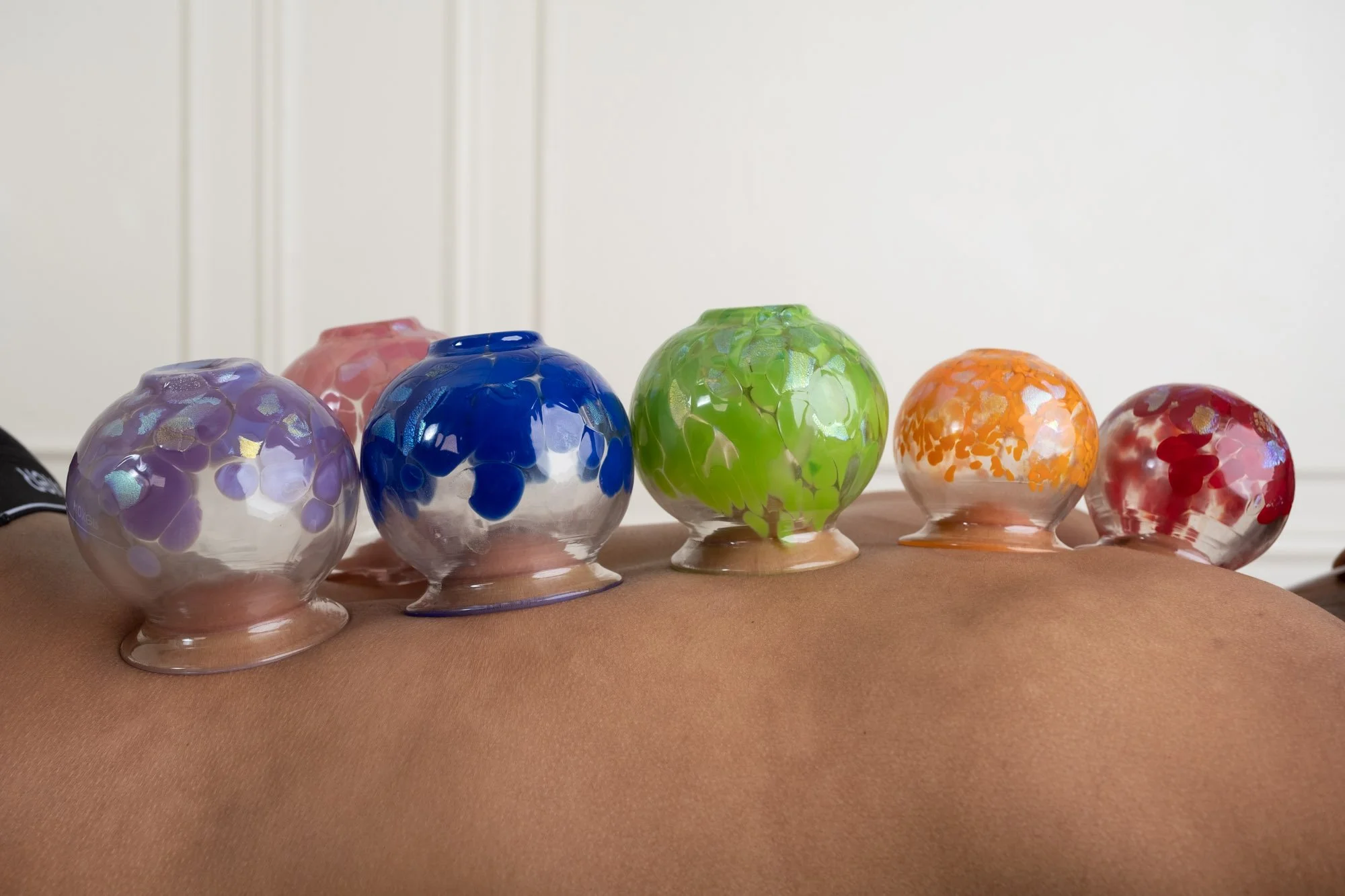 Cupping: What To Expect And Aftercare — Emily Grace Acupuncture