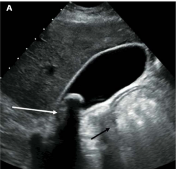 Overview of Artifacts in Diagnostic Ultrasound — Temple Point-of-Care ...