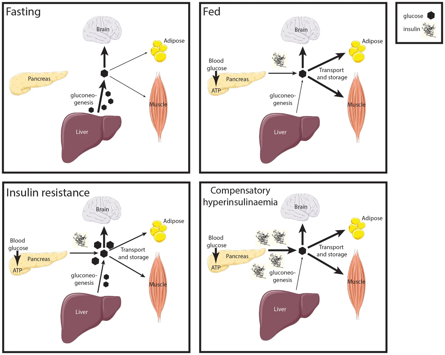Insulin Resistance — METABOLIC CYBERNETICS