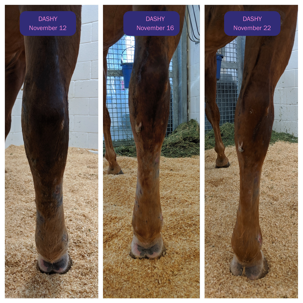 Chronic Cellulitis With Open Wounds — Serendi/DXN