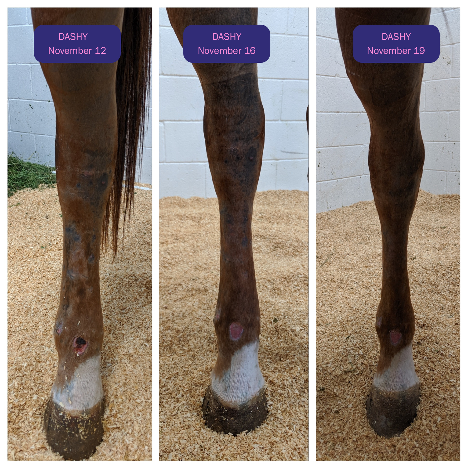 Chronic Cellulitis With Open Wounds — Serendi/DXN