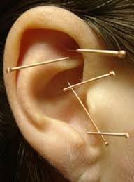 Healing With Ear Acupuncture — Balance Acupuncture - Charleston, SC