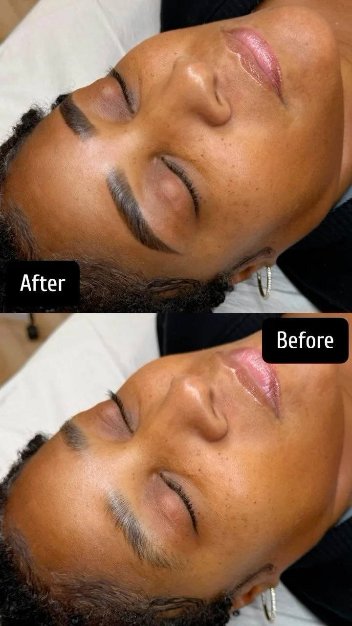 Custom Facials in Philadelphia, PA | Forever Valentine Beauty