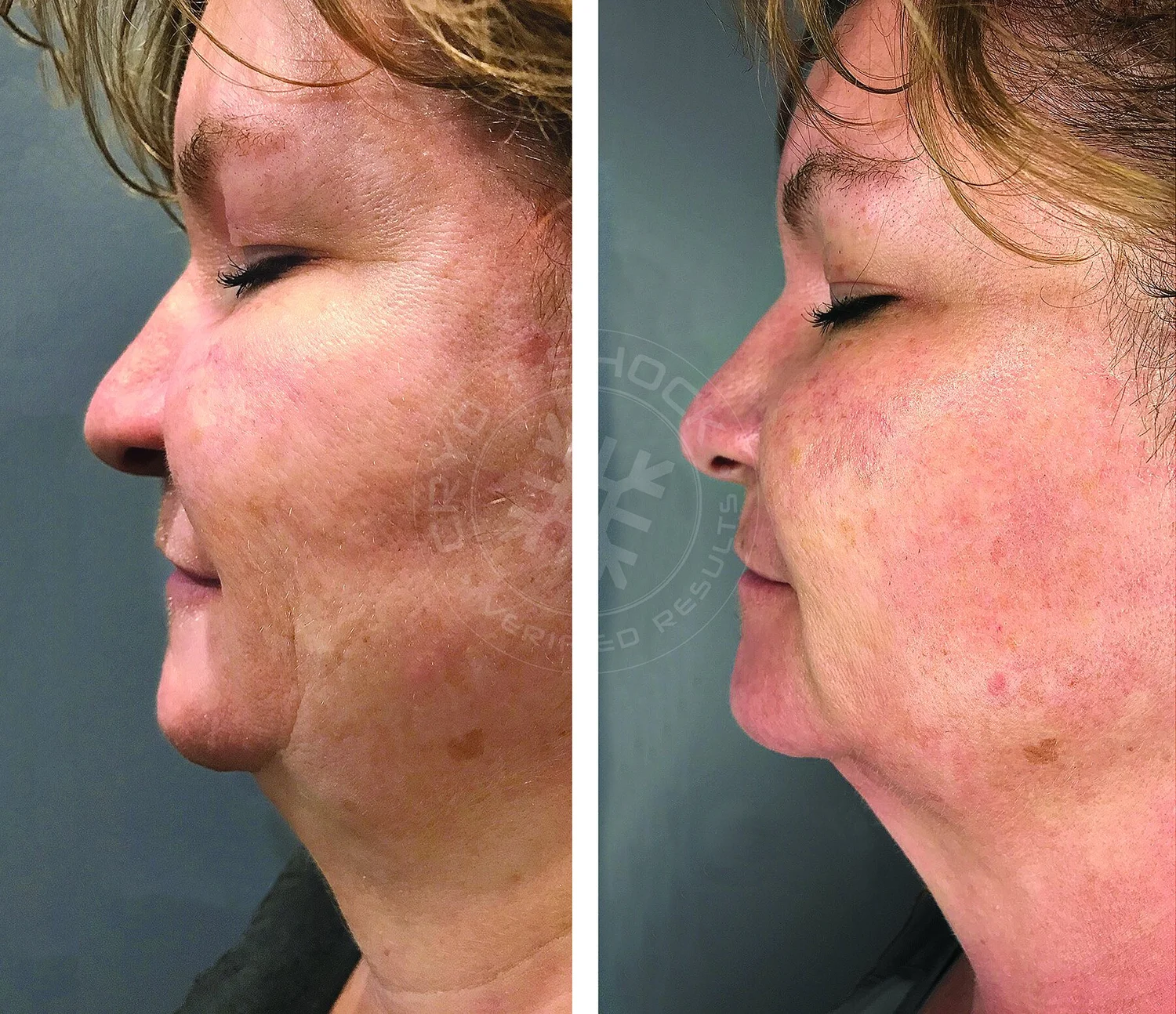 Cryo T-shock — CRYO ENERGY