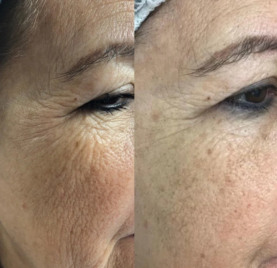 Fillmed NCTF — Charlene Baker - PMU & Microblading