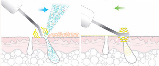 Ultrasonic Skin Scrubber — Extend®️ Lash & Co