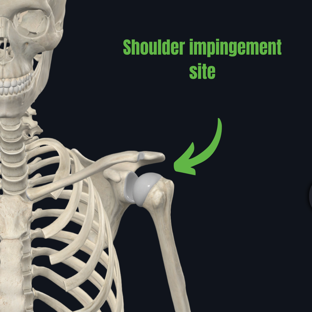 What is shoulder impingement? Can Physio help? — Aevum Physiotherapy