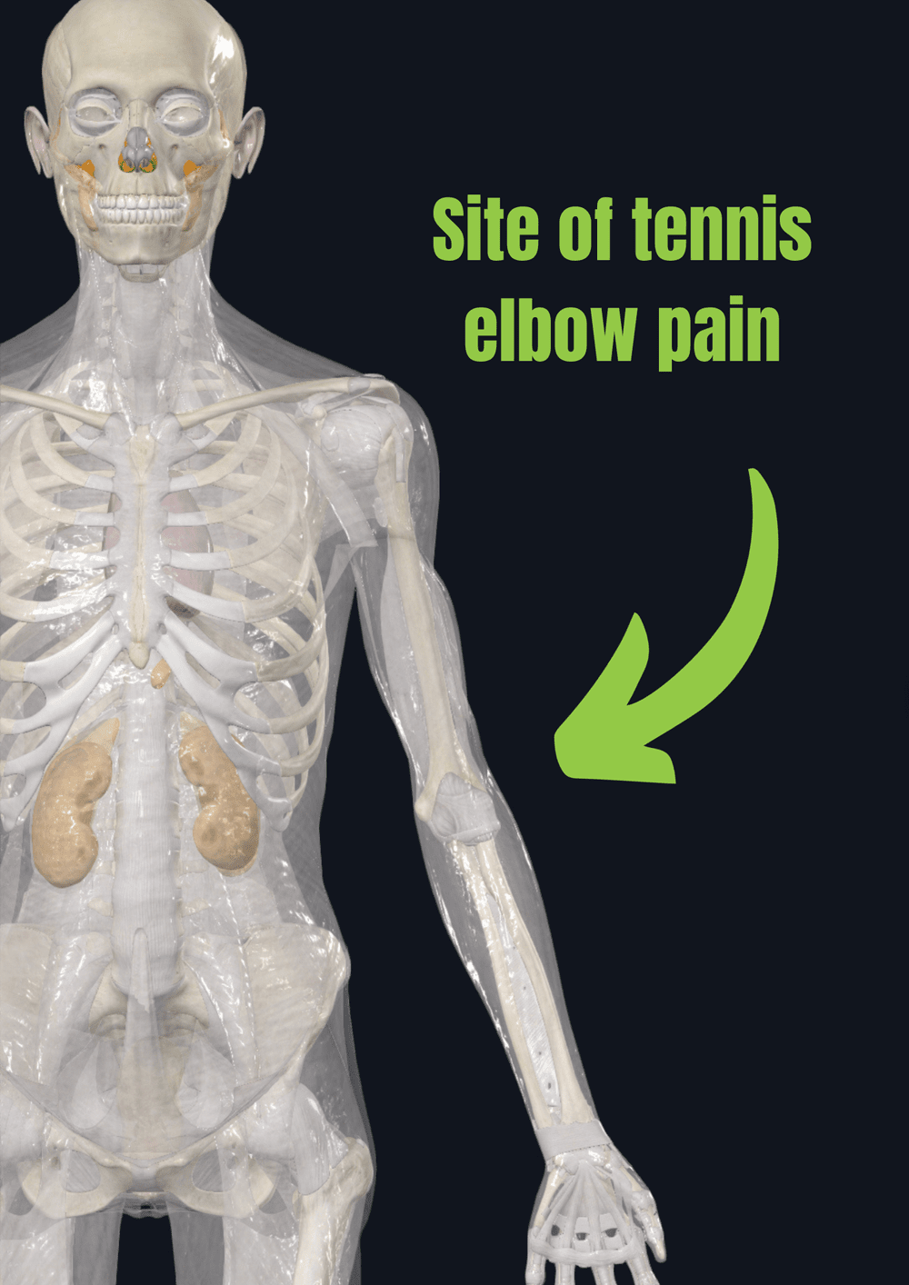 Better Understanding Tennis Elbow and How Physiotherapy Can Help ...