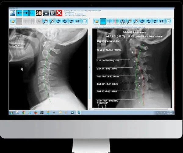 X-ray imaging services — Chiropractor St. Thomas US Virgin Islands