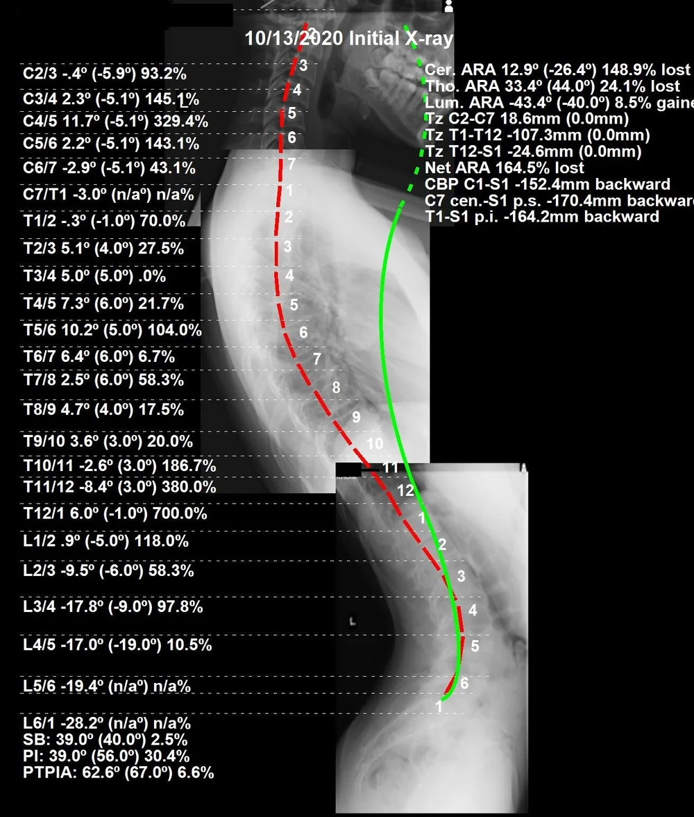 X-ray imaging services — Chiropractor St. Thomas US Virgin Islands