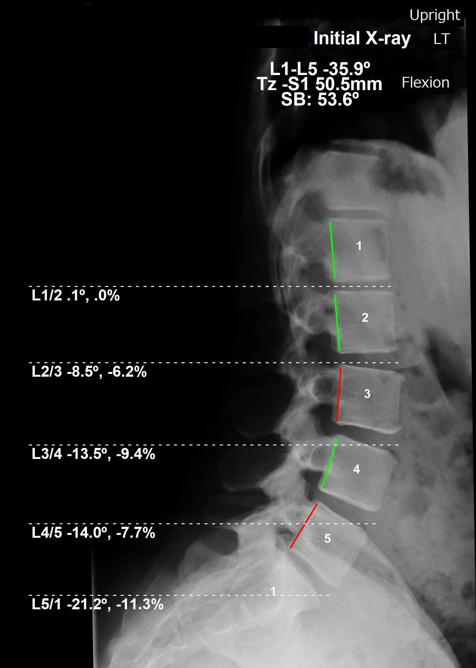 X-ray imaging services — Chiropractor St. Thomas US Virgin Islands