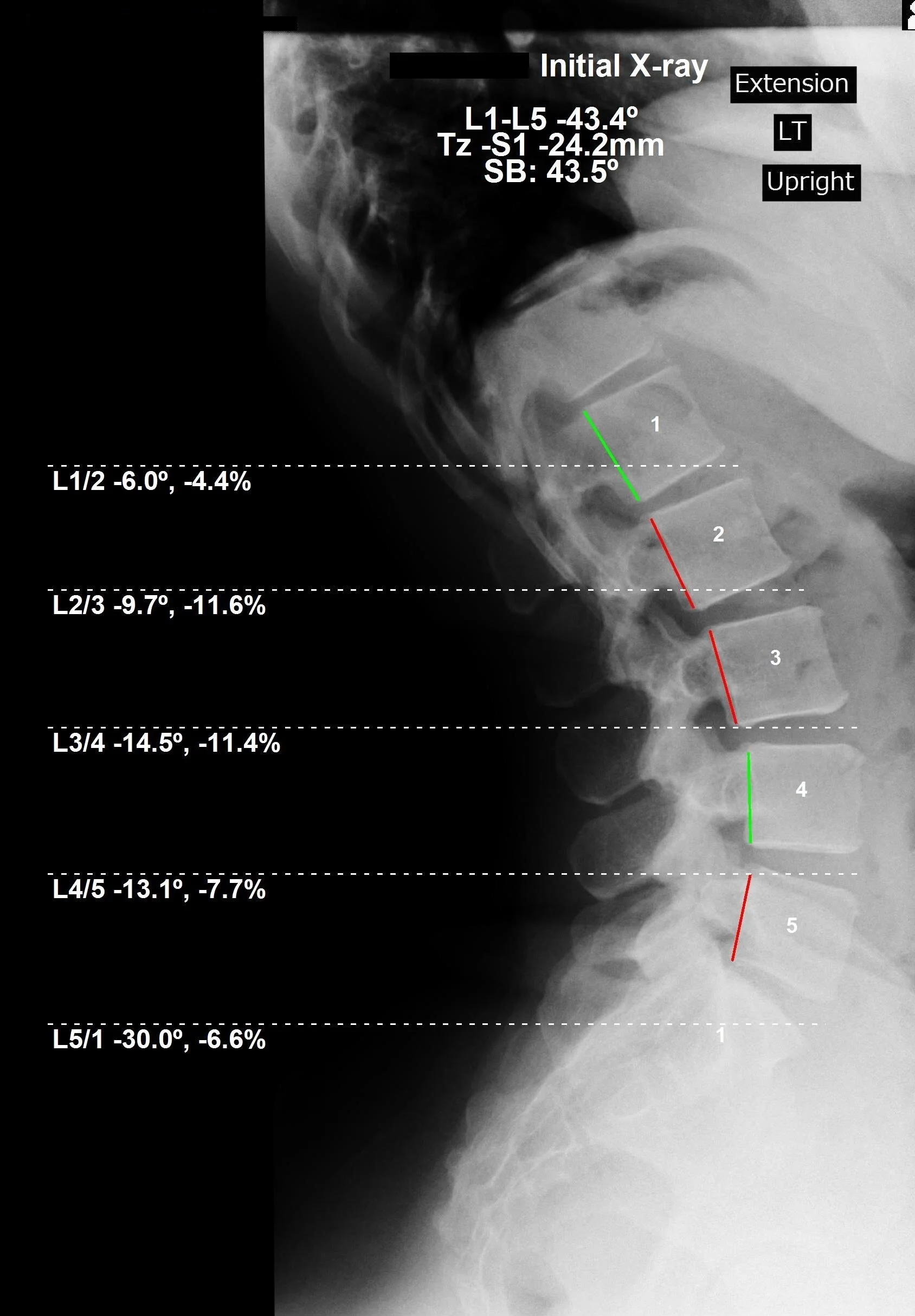 X-ray imaging services — Chiropractor St. Thomas US Virgin Islands