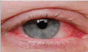 February 2020 Newsletter — Eye Centers of Northwest Ohio