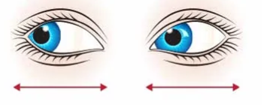 Vestibular Therapy and How You Can Perform Them at Home ...