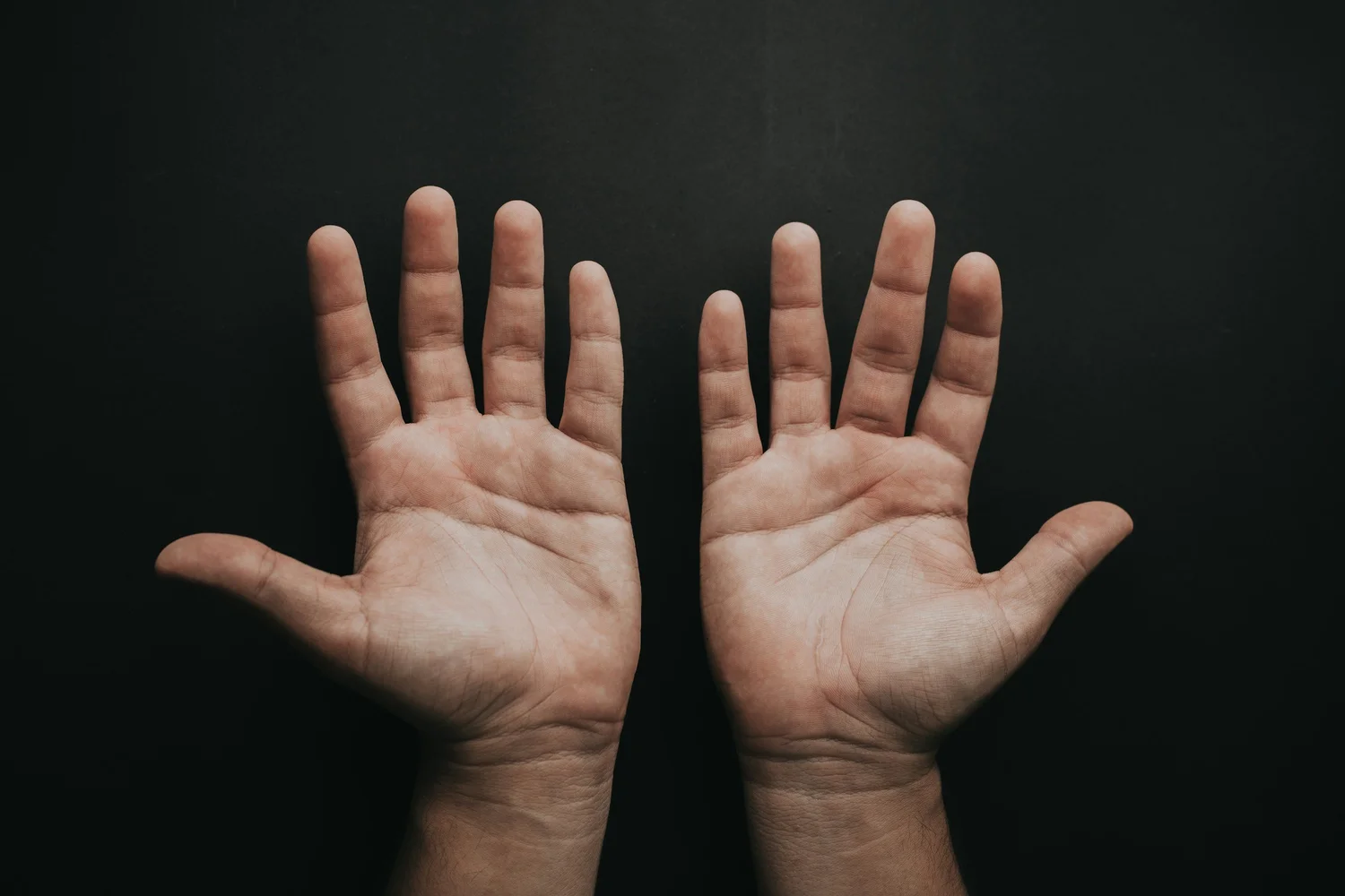 7 Common Causes of Finger Numbness and What They Mean ...
