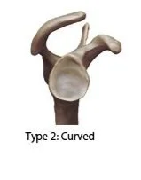 Dealing With Acromion Pain With The Best Exercises For Relief ...