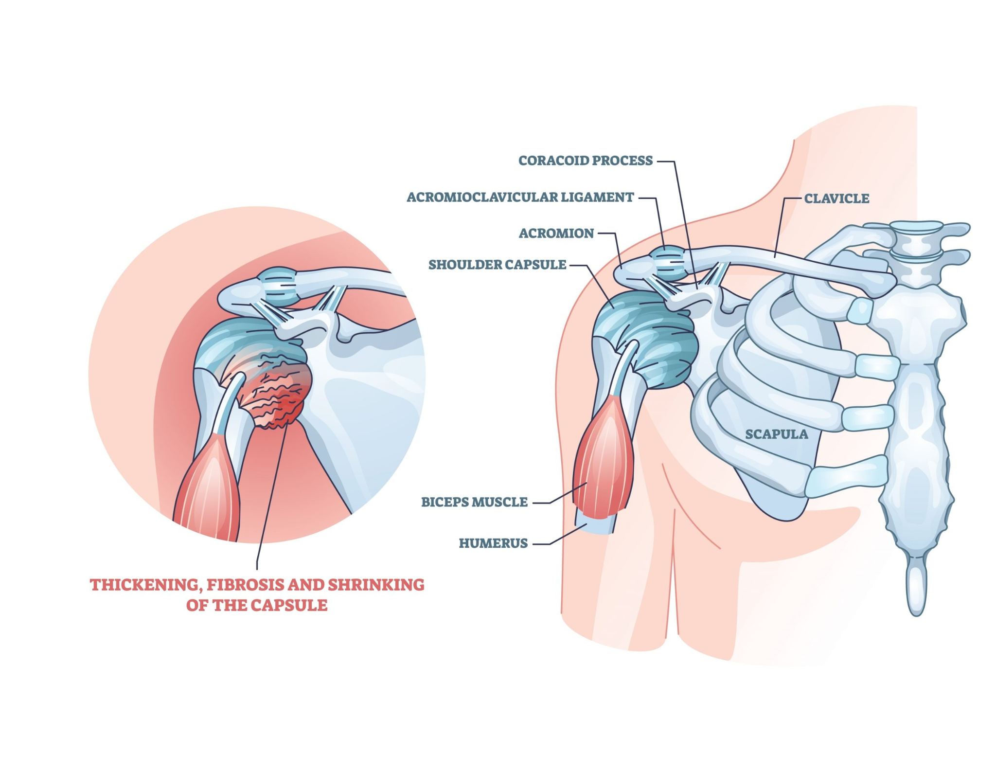 Acromion Process