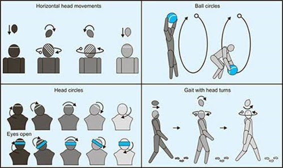 Vestibular Therapy and How You Can Perform Them at Home ...