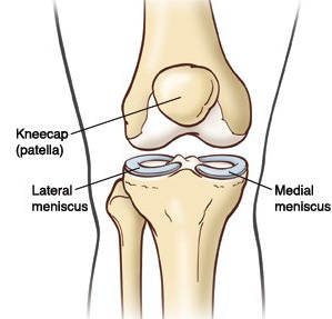 Meniscal Tears Recovery Time: Key Facts, 6 Best Exercises for Optimal ...