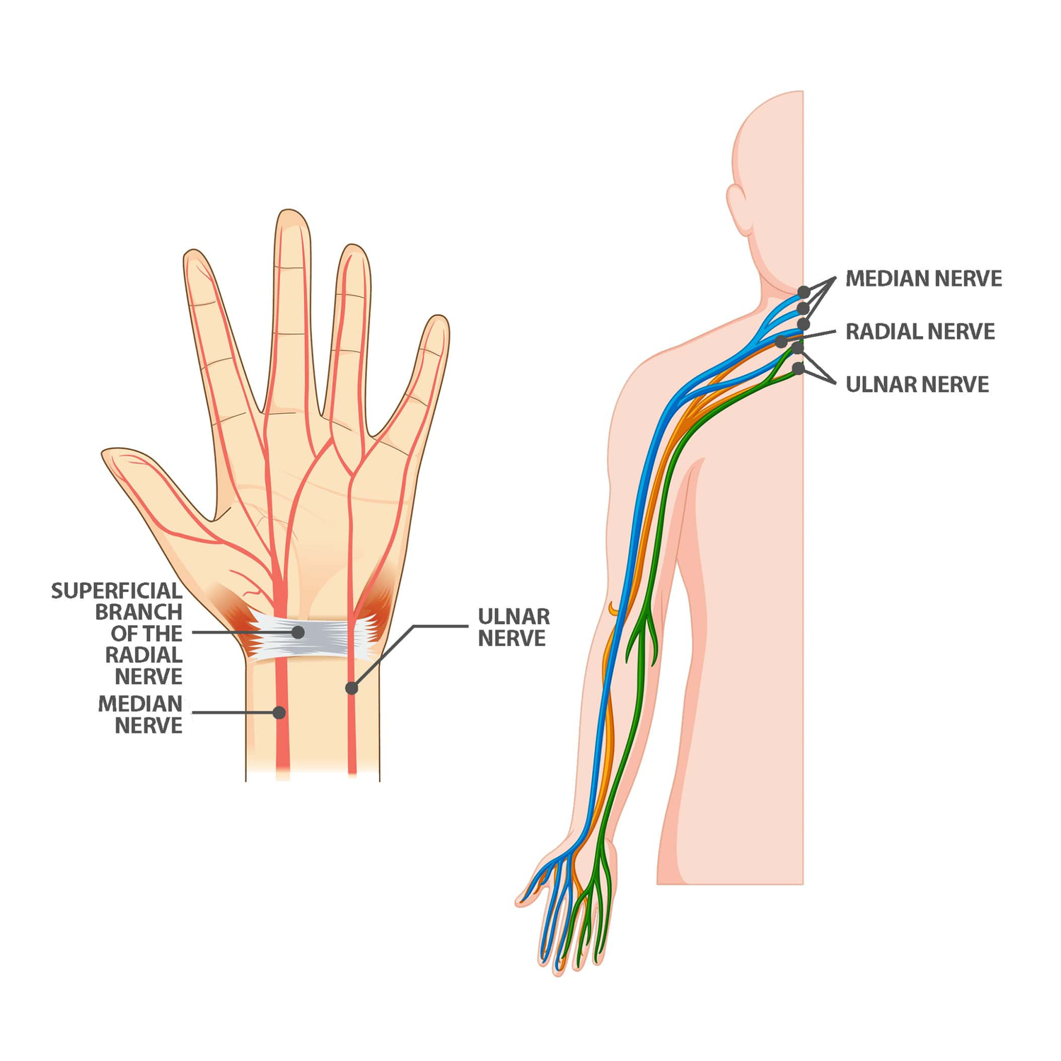 Ulnar Nerve Entrapment Causing Pinky Or Ring Finger Numbness ...