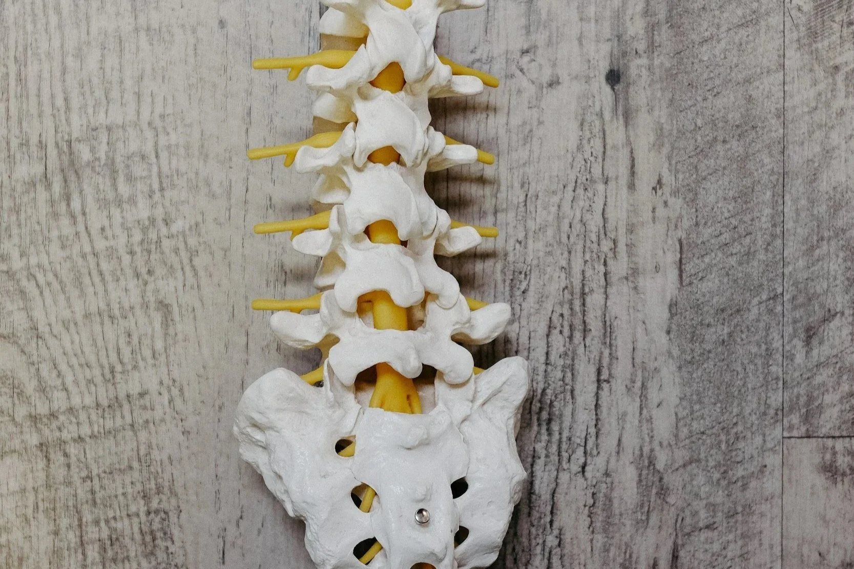 7 Best Exercises for Sciatic Nerve Pain | Physiotherapists in Toronto ...