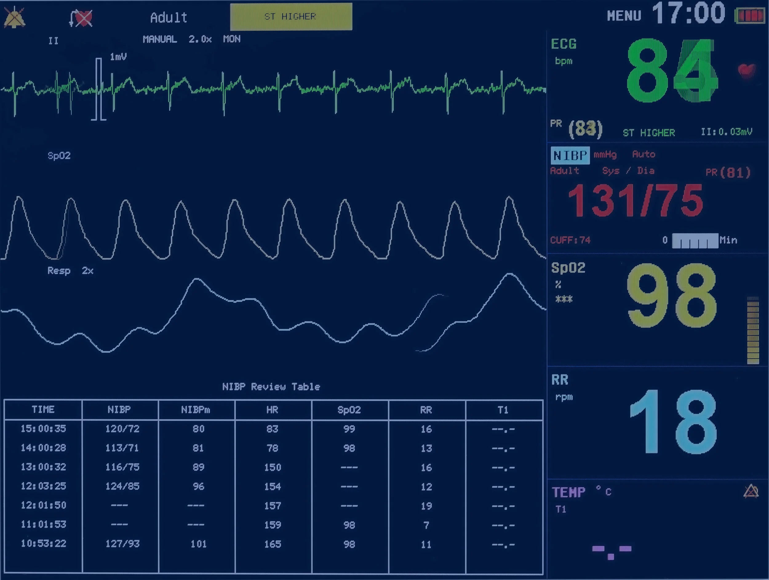 Advanced Cardiovascular Life Support Course in Boston, MA - ACLS Academy