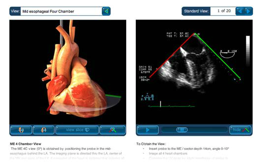 Learning resources — RESUSCITATIVE TEE PROJECT