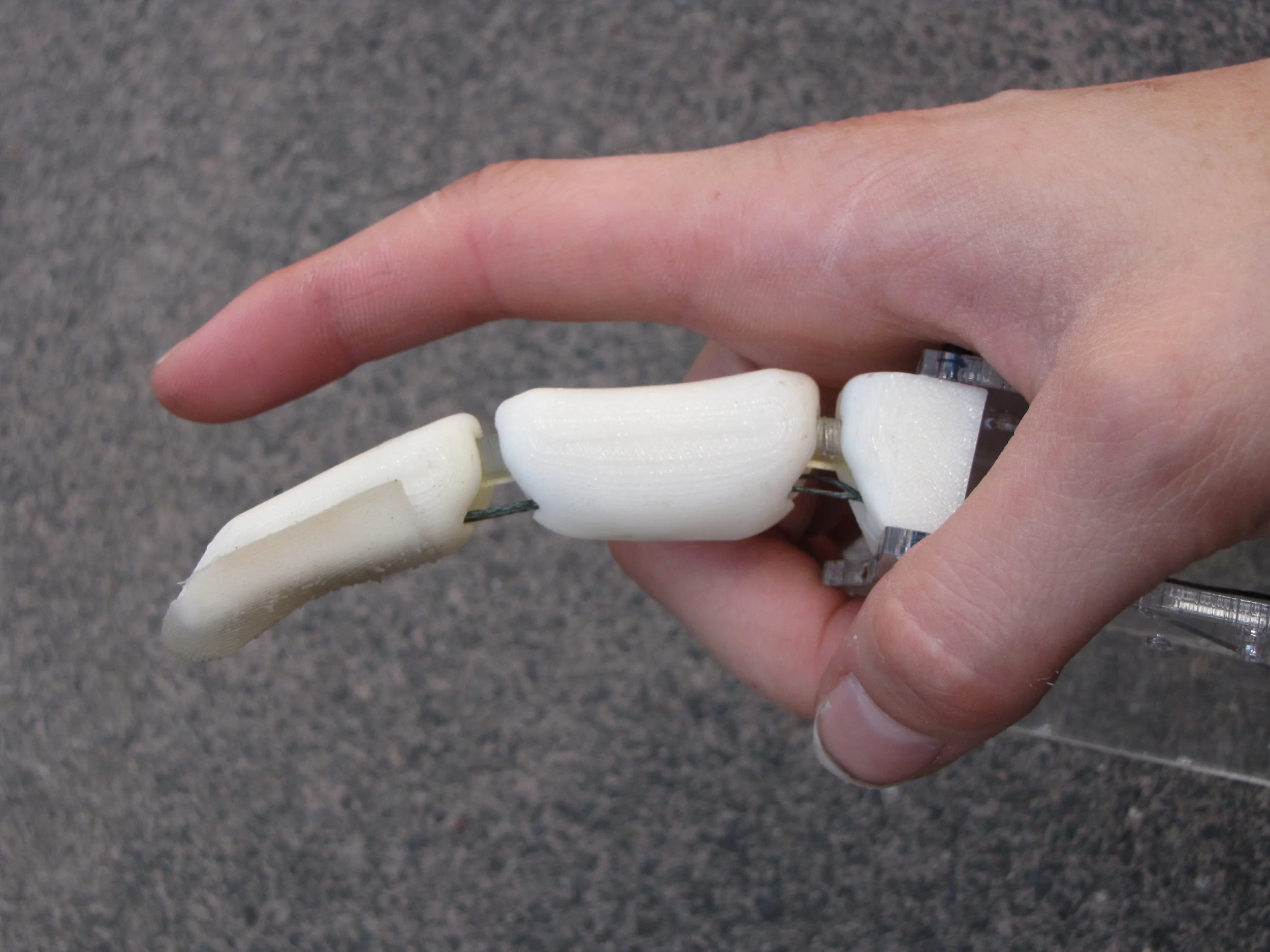 Prosthetic Hand — Kayla Matheus