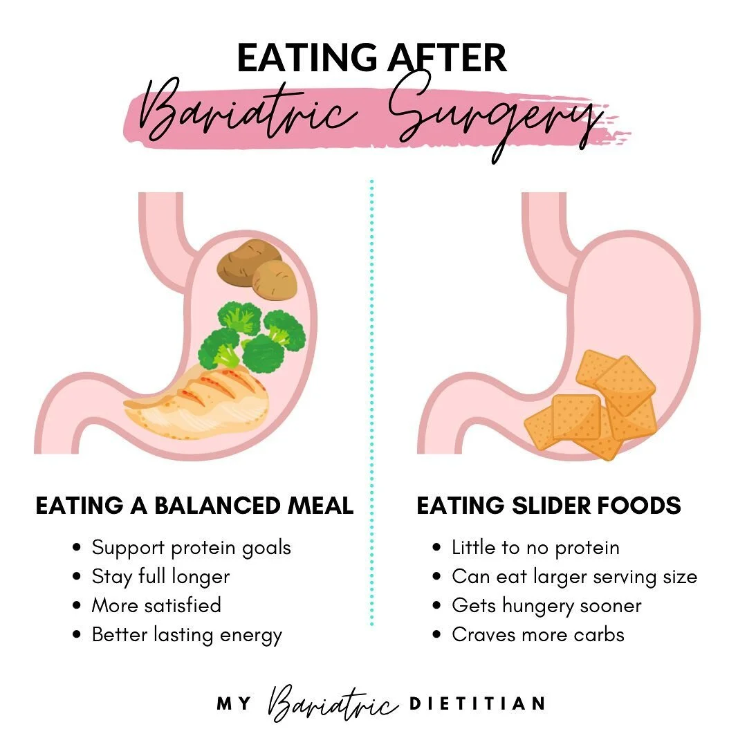 My Bariatric Dietitian-Bariatric Nutrition Support For Weight Loss ...