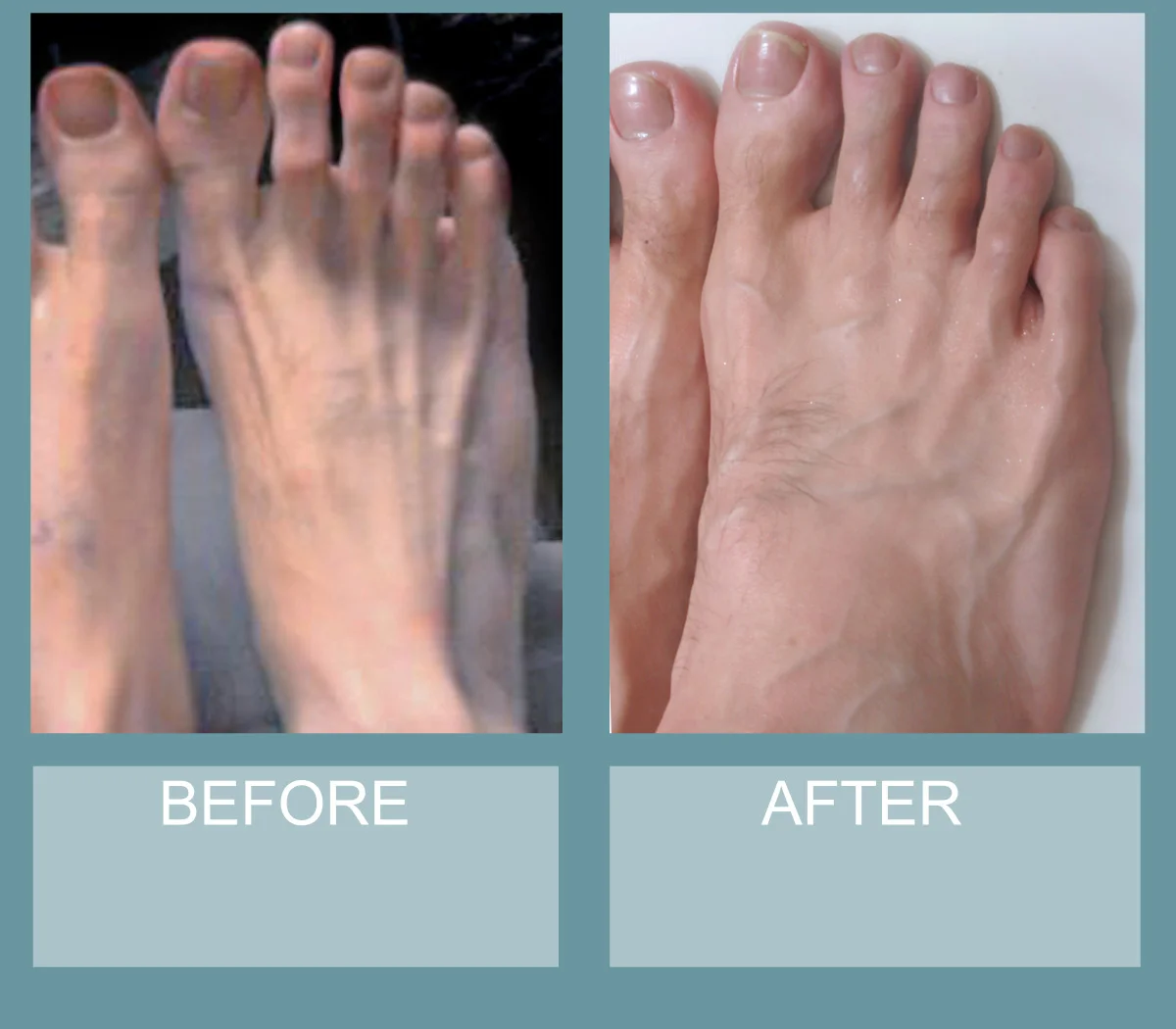 Bunions & Hammertoes Doctor | New York City Podiatrist — DR. FABIENNE ...