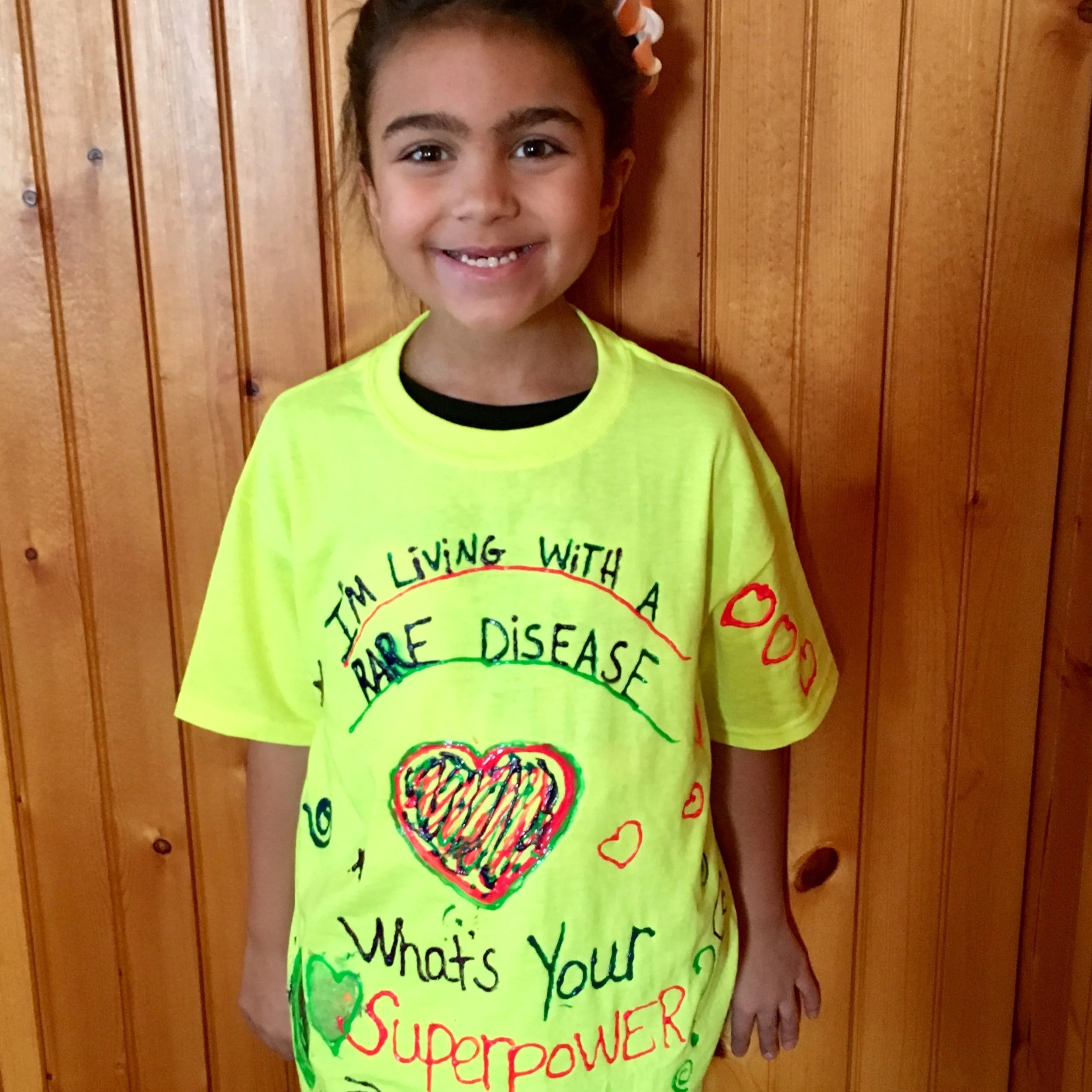 Living with Greig Cephalopolysyndactyly Syndrome — Know Rare