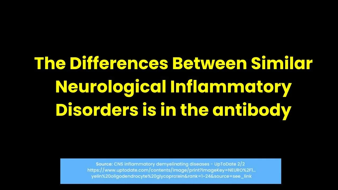 Help with MOG — Know Rare