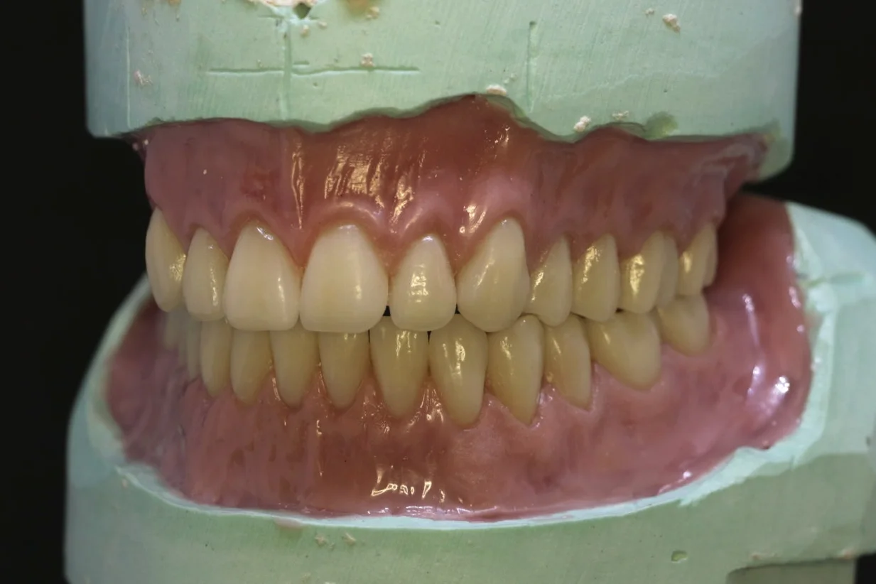 Gallery — Signature Denture Studio