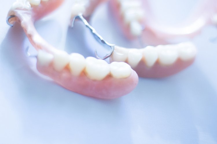 Metal Partial Dentures Kerang | Signature Denture Studio