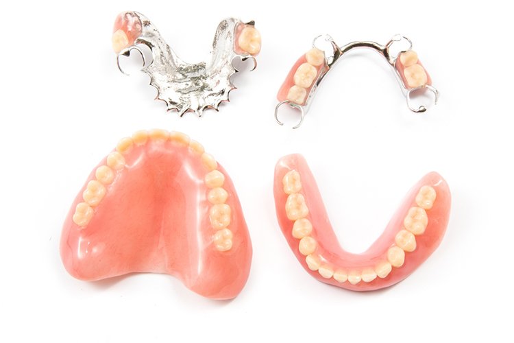 Metal Partial Dentures in Moama | Signature Denture Studio