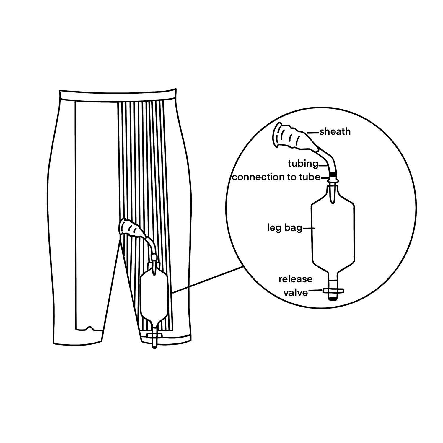 No painful leg straps with New URO Urinary Suspensory System — URO ...