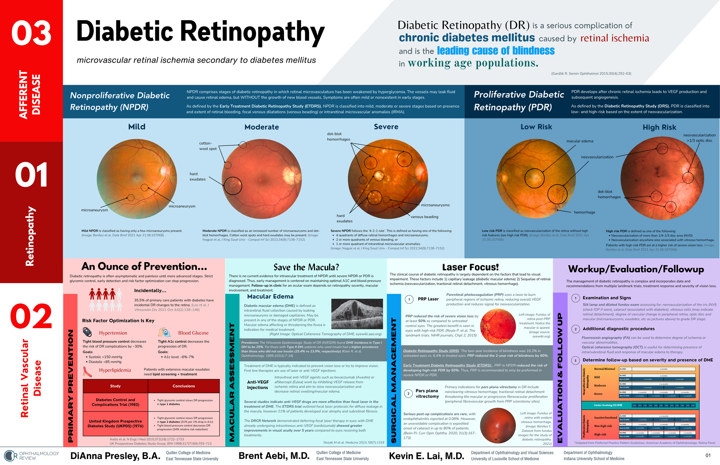 Diabetic Retinopathy (Coffee Table Book) — Ophthalmology Review