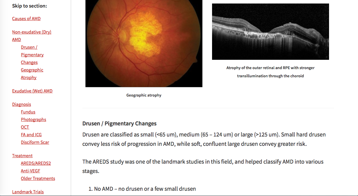 Website Review: EyeGuru — Ophthalmology Review
