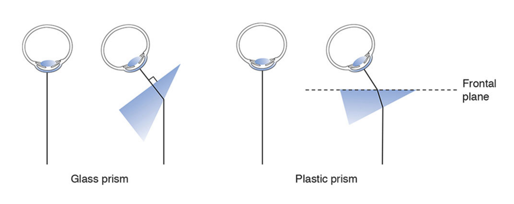 Introduction To Clinical Prisms — Ophthalmology Review
