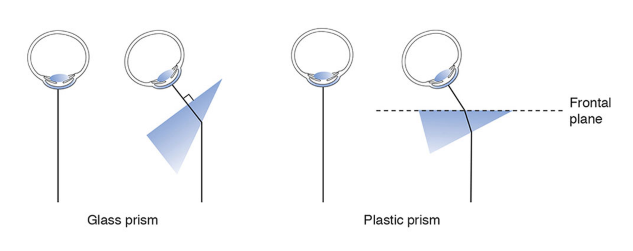 Introduction To Clinical Prisms — Ophthalmology Review